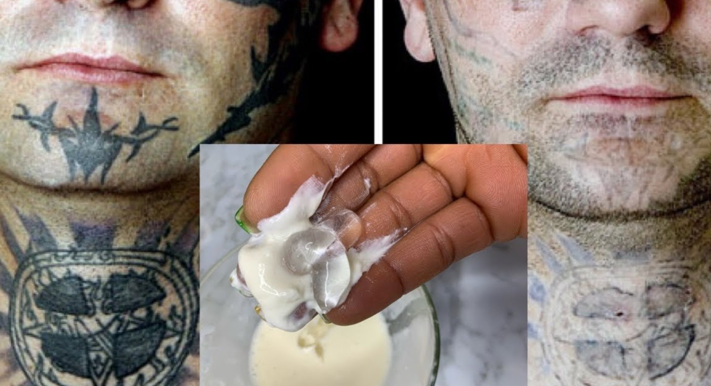 How to Fade a Tattoo? - TattooProfy