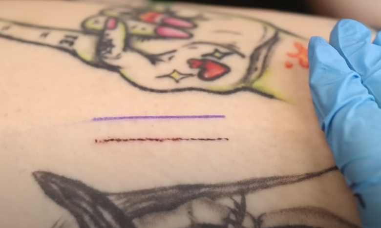 Why Is My Tattoo Raised? - TattooProfy